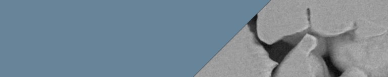 Vyon® Porous Plastic Materials | Vyon Porous Plastics